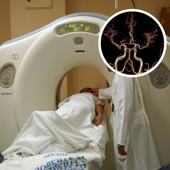 CT Brain Angiography Near You In Delhi Test At Lowest Price Ganesh CT Brain Angiography Near You In Delhi Test At Lowest Price Ganesh